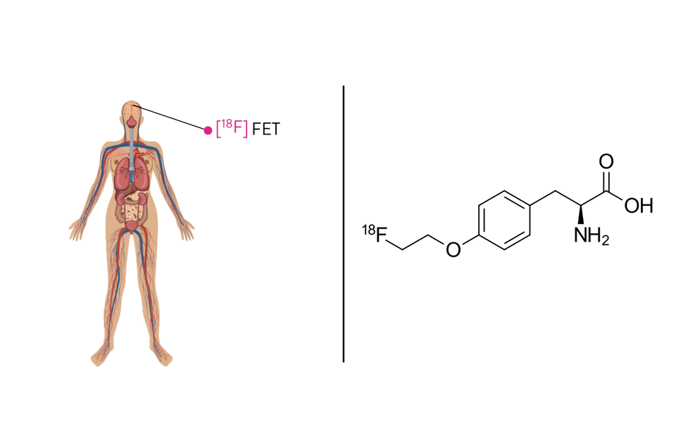 [18F]FET | Trasis