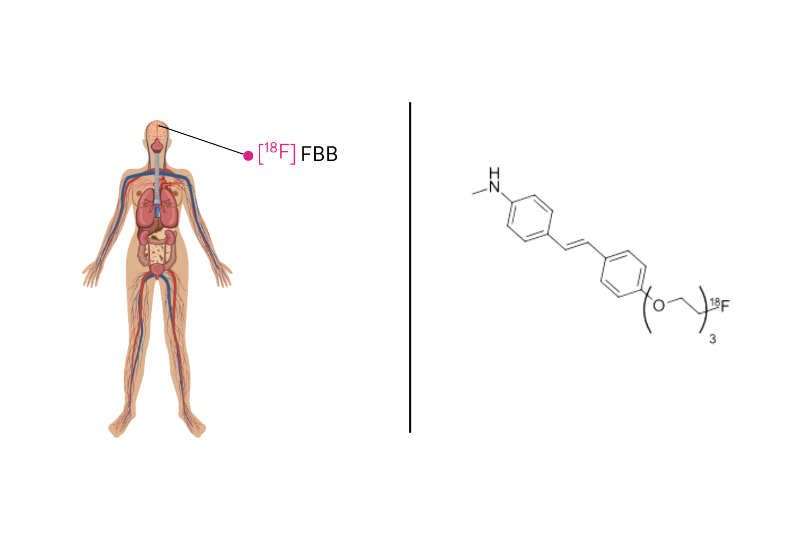 [18F]FBB-Neuraceq™ | Trasis